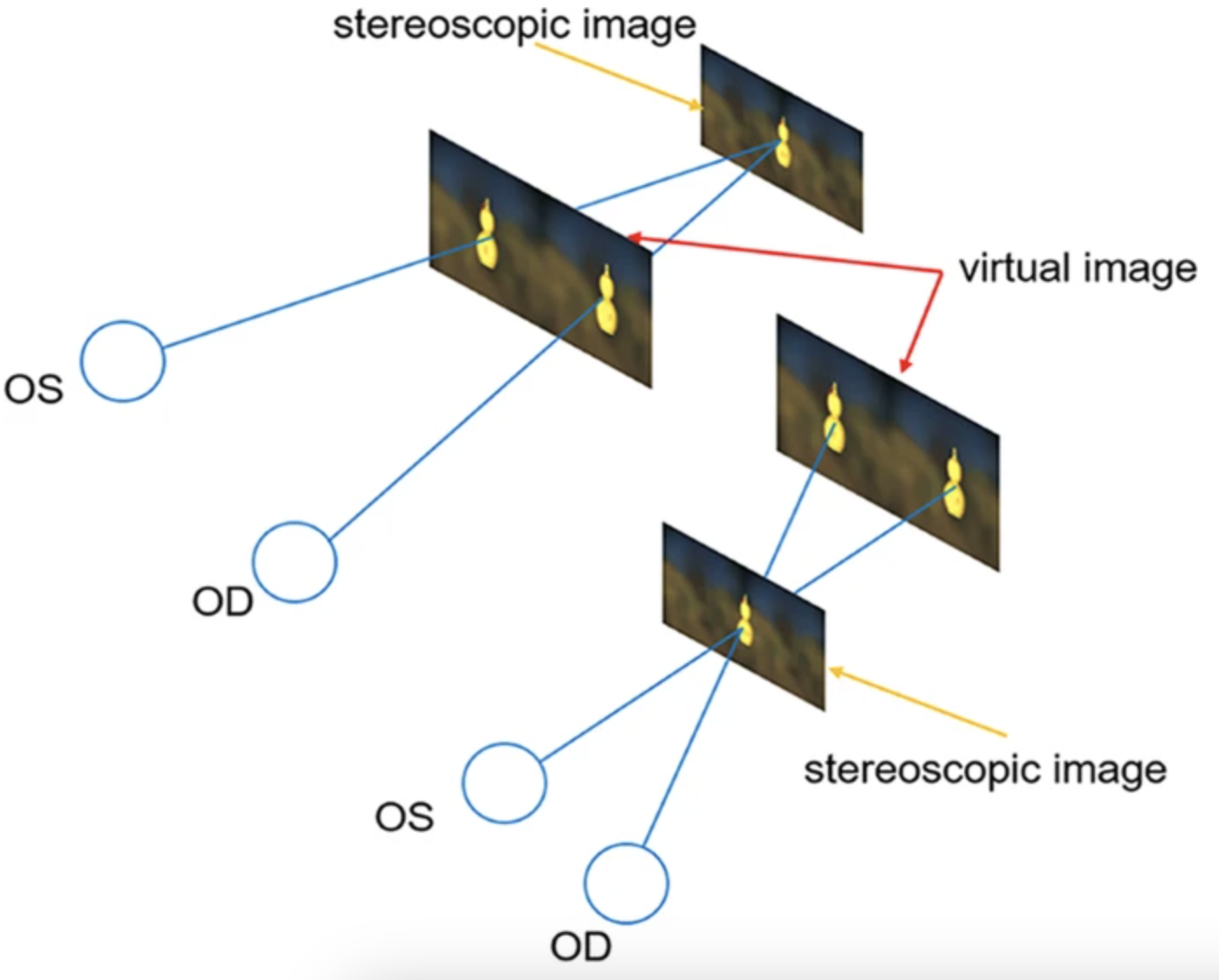 Through a New Lens: The Promise of Virtual Reality for Enhancing Vision ...
